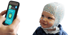 Cranial Molding Helmets | Lawall